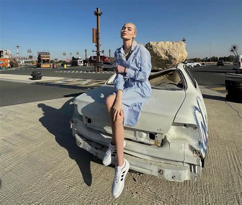 Алена Шишкова сделала липосакцию