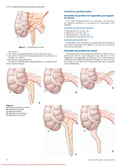 Solution Acute Appendicitis 19 Studypool