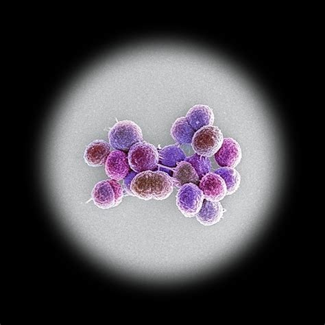 Streptococcus Faecalis