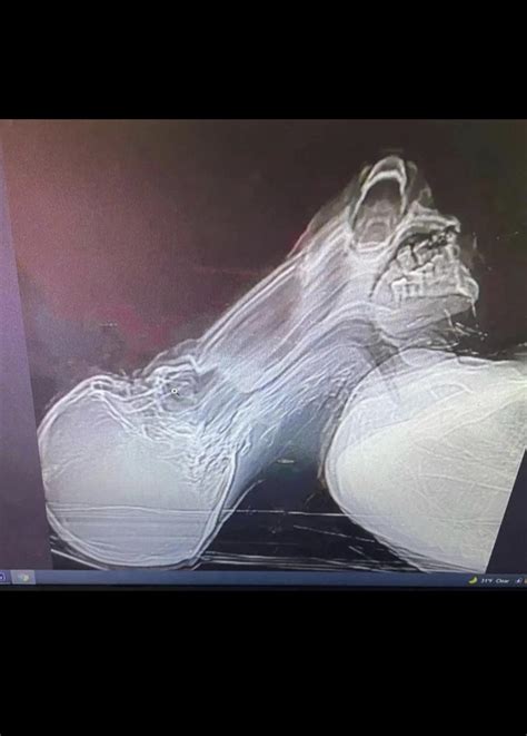 X Raying Out R Weird