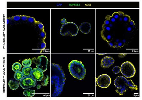 Pneumacult™ Alveolar Organoid Media Stemcell Technologies
