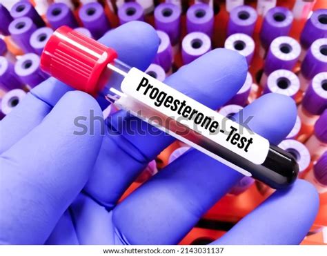 571 Progesterone Test Images Stock Photos Vectors Shutterstock