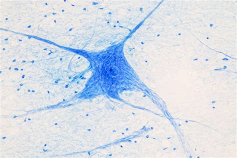 Multipolar Neuron Under Microscope