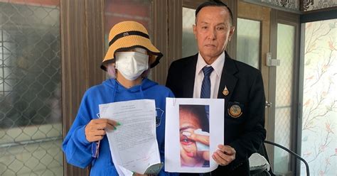 친구 추천으로 속눈썹 연장술 받고… 안구 적출 당한 태국 여성