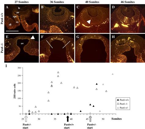 Precocious Retinal Neurons Pax6 Controls Timing Of Differentiation And