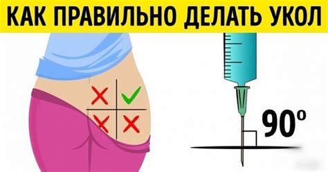 Как сделать укол в задницу