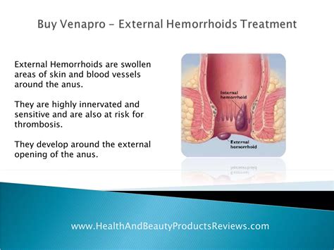 Buy Venapro External Hemorrhoids Treatment Ppt Digestive