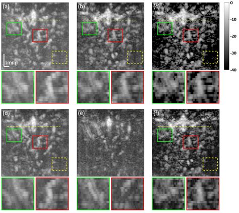 Deep Unfolded Robust Pca With Application To Clutter Suppression In Ultrasound Myriad