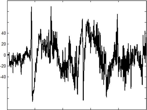 A Sample Of Eeg Signals After Artifact Removal Process Download Scientific Diagram