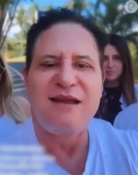 Se arrependeu Marrone esclarece novo procedimento estético no rosto