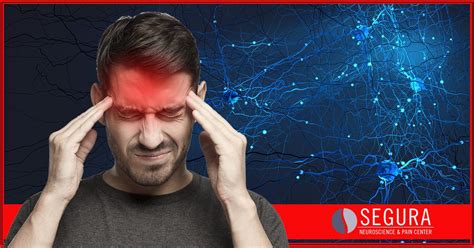 Spg Block For Migraines Segura Neuroscience And Pain Center