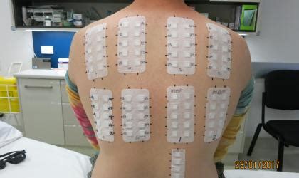 Dermatology SA Patch Testing Dermatology SA