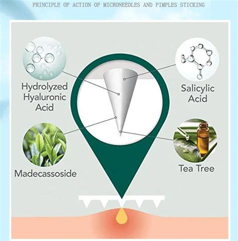 Microdart Pimple Patches Acne Spot Patches Forehead Microneedle Patch