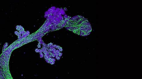 Likely “cells Of Origin” Pinpointed For Breast Cancer Technology Networks