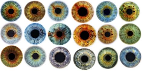 Rh Negatives May Have An Elevated Frequency Of Central Heterochromia