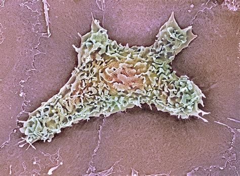 Macrophage Cell Sem Photograph By Thomas Deerinck Ncmir Fine Art