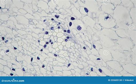Ovary Of Lilium In Transversal Section Under Microscope 400x Against