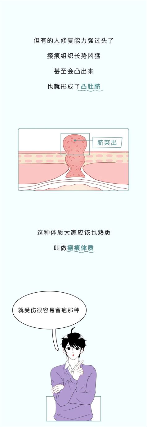 为啥肚脐眼有凹有凸跟护士的打结手法有关吗 百科TA说