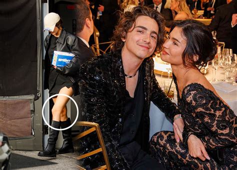 Kylie Jenner Exposes Her ‘wonky Real Knees That Look ‘dislocated News