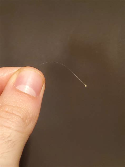 Large White Bulb From Lost Hair Tressless