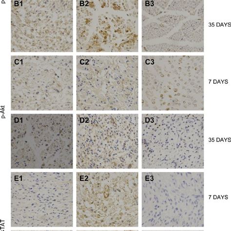 Cross Semithin Sections Of Regenerated And Normal Sciatic Nerves In Download Scientific Diagram