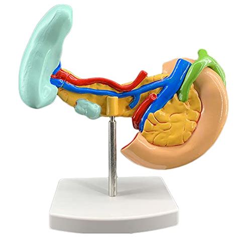 Buy Fhuili Duodenum Model Human Organ Anatomy Model Diseased Pancreas