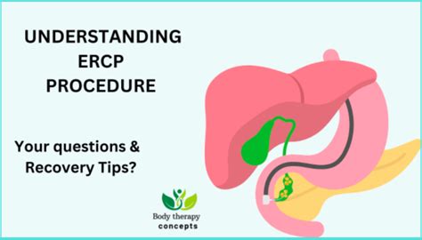 Understanding ERCP Procedure Your Questions Tips For Recovery