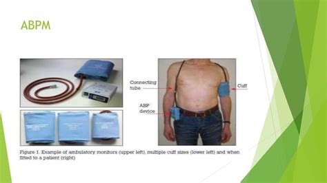 Ambulatory Bp Monitoring Pptx