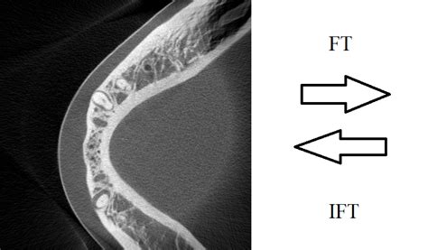 Fourier Transform Converts A Signal A Into Its Frequency Domain Download Scientific