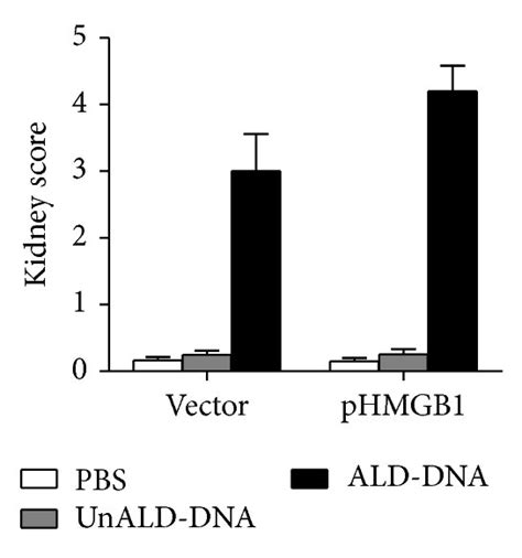 Hmgb1 Overexpression Could Promote The Severity Of Sle Balbc Mice
