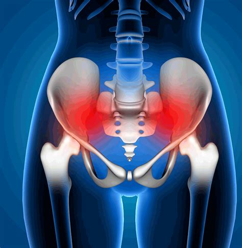 Sacroiliac Joint Dysfunction Phillip Island Massage Therapy