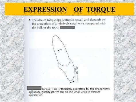 Torque In Orthodontics Pptx