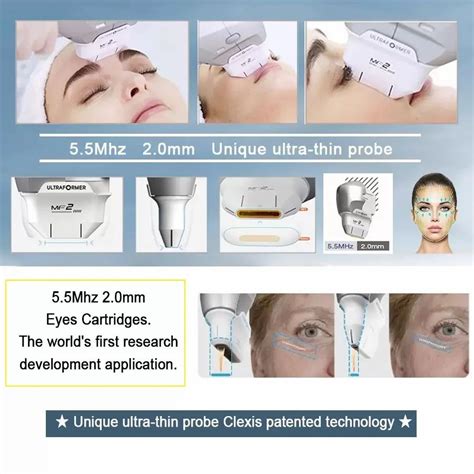 Portable 7d Hifu Slimming High Intensity Focused Ultrasound Hifu Face