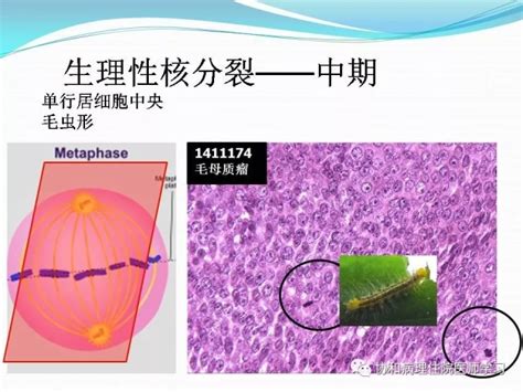病理学基础知识 核分裂像的识别 资讯频道 华夏病理网