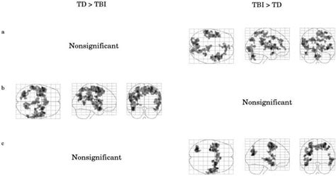 Maximum Intensity Projection Maps Of Between Groups Contrasts For A