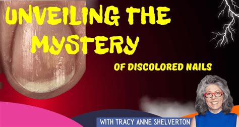 Unveiling The Mystery Of Discolored Nails Nailknowledge