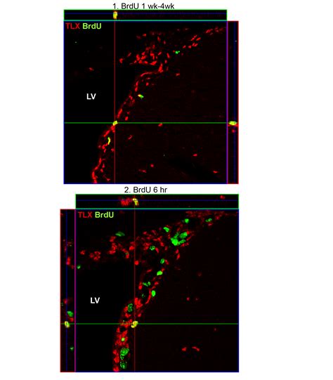 Characterization Of Tlx Expression In Neural Stem Cells And Progenitor