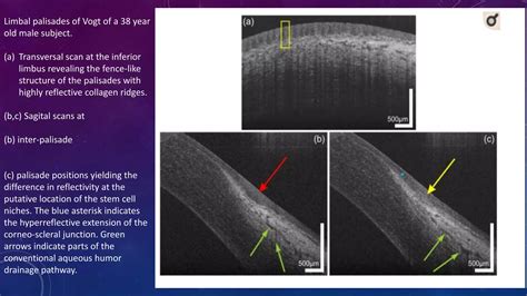 Anterior Segment And Corneal Oct Review Ppsx