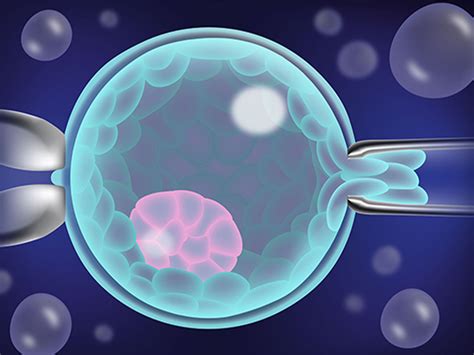 Pgt White Rose Fertility Centre Pgt White Rose Fertility Centre