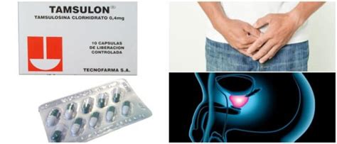 Tamsulon Indicaciones Mecanismo De Acción Dosis Efectos Secundarios