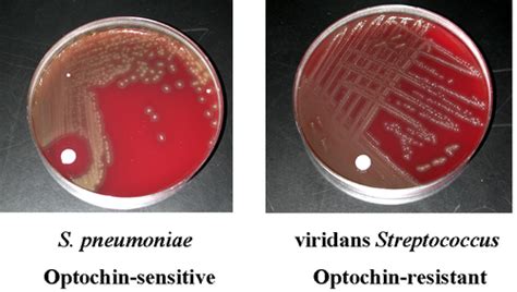 Pc2 3 1 4 Streptococcus Pneumoniae Flashcards Quizlet