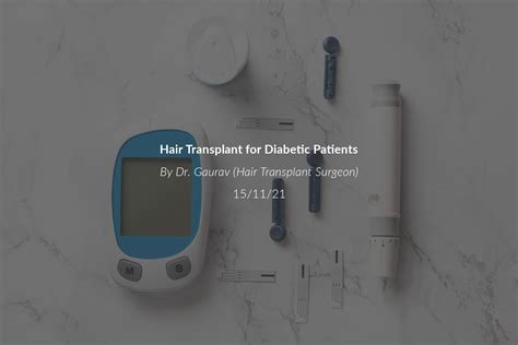 Hair Transplant For Diabetic Patients Cult Aesthetics