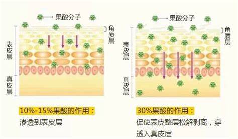 果酸换肤原理 果酸换肤效果 果酸换肤 第11页 大山谷图库