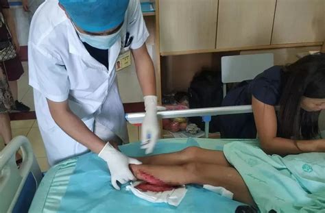 注意！今日起，绵阳集中整治犬只饲养！二环路内为限养区！对狂犬、伤人犬，一律捕杀！养犬