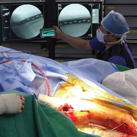 Surgical Process Of Patient 1 A Before Making The Incision The