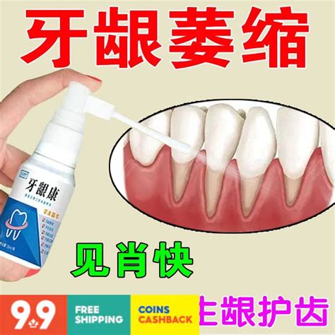Probiotic Gingival Recession Special Repair Reative Tooth Root Exposegum Atrophy Special Repair