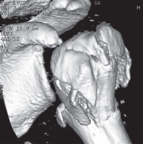 Shoulder Radiology Key