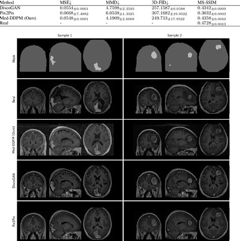 Figure 2 From Conditional Diffusion Models For Semantic 3d Medical Image Synthesis Semantic