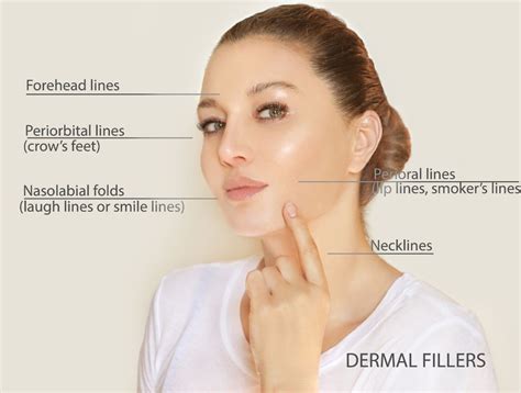 Dermal Fillers Ls Medical