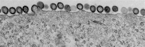 Microscopy Jaisri Lingappas Lab